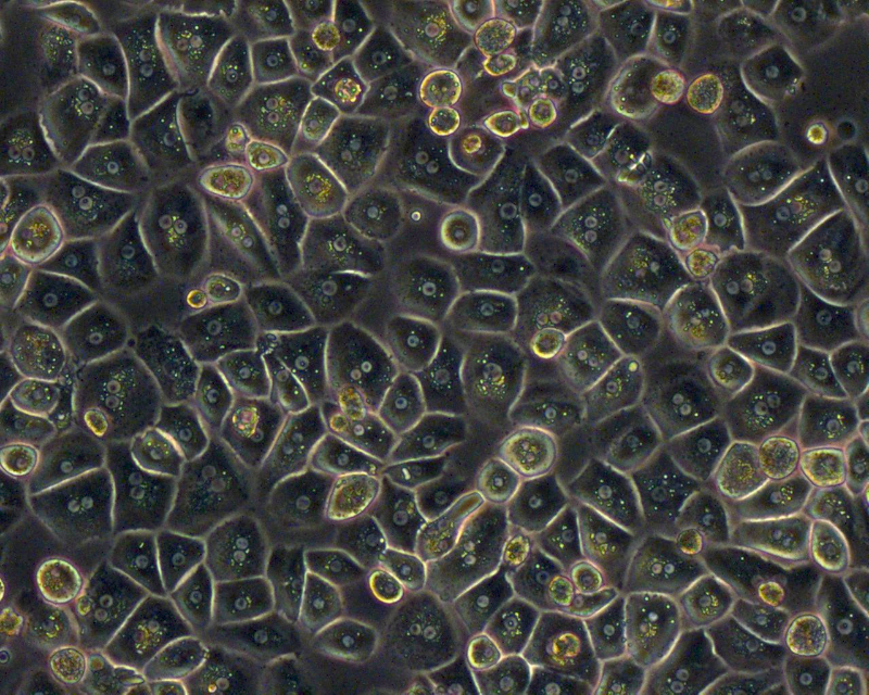 Liver Cell Isolation